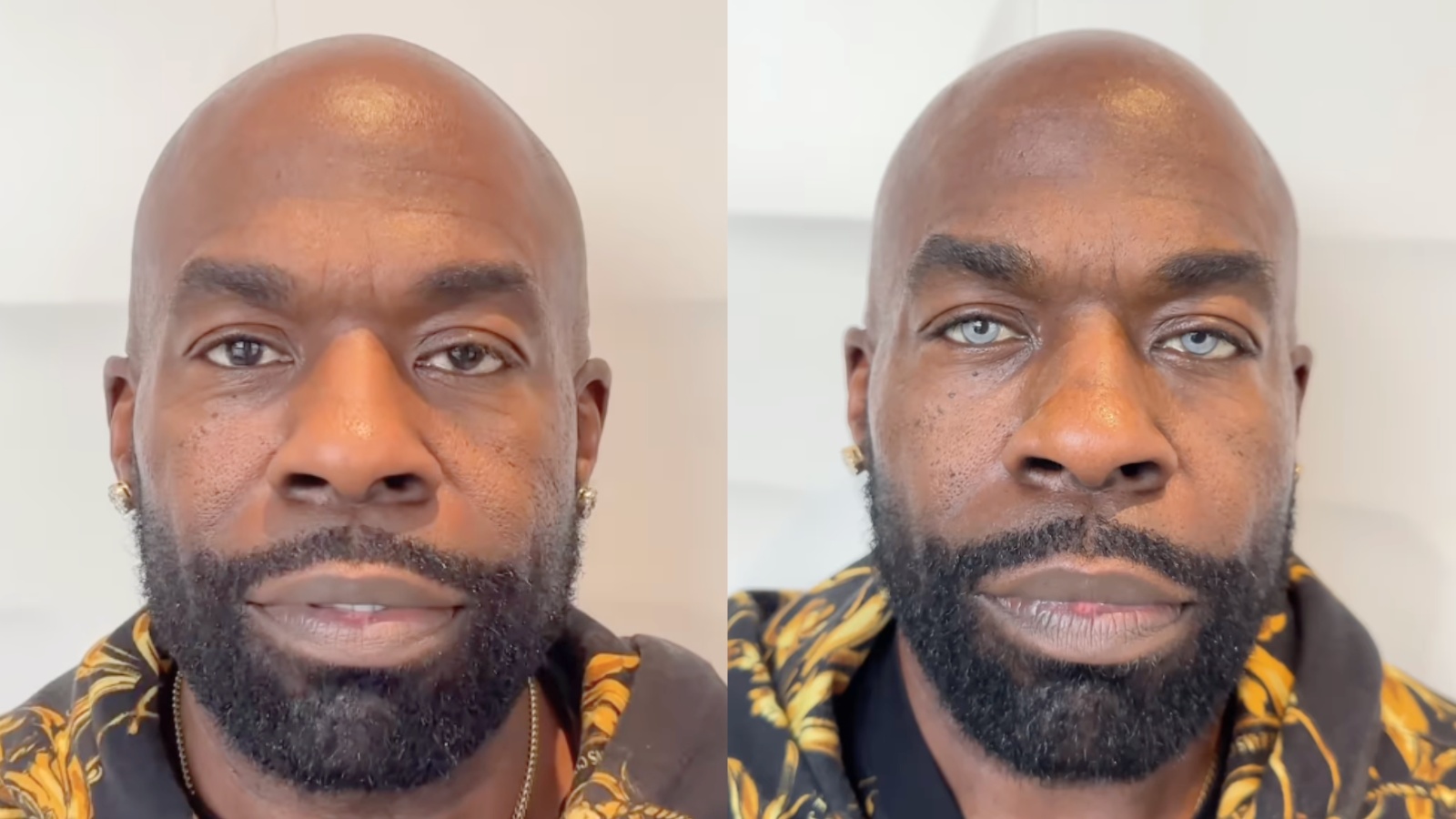 Le bodybuilder Kali Muscle subit une opération pour changer ...